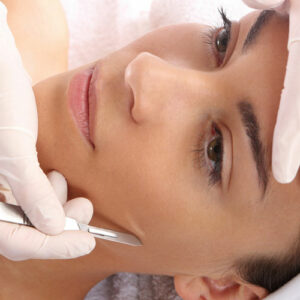 Dermablading or Dermaplaning - What's the Difference? | Skinthetics ...